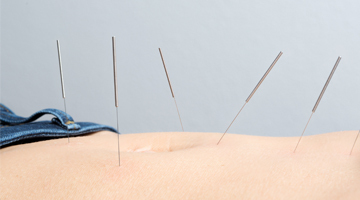 Abdominal Acupuncture Courses | Master Tung's Acupuncture | eLotus CORE